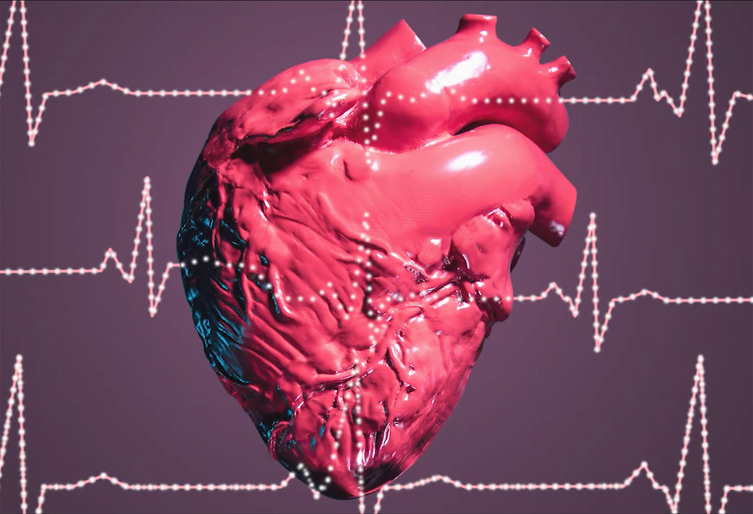 Unlocking Innovations in Cardiac Care ️ Electrophysiology Symposium on ...